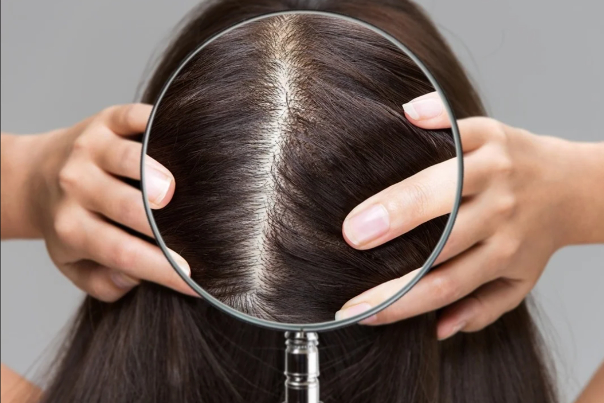 Understanding The Scalp Microbiome - ToniAndGuy.com.hk